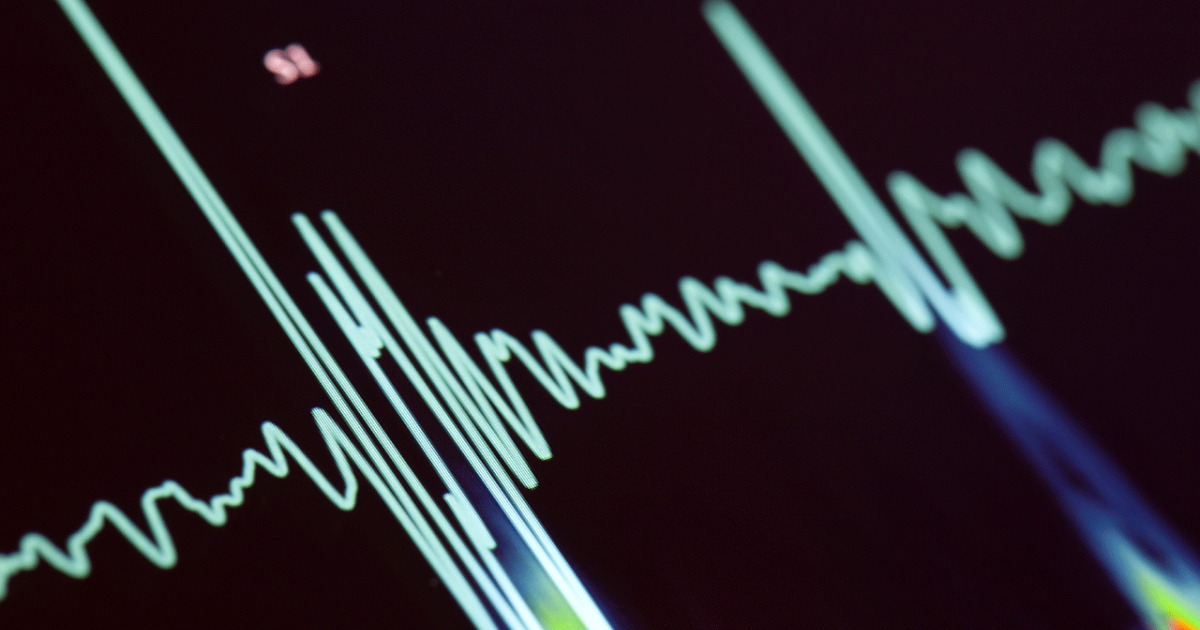 Ansiedade: o que é, sintomas e tratamento | CUF