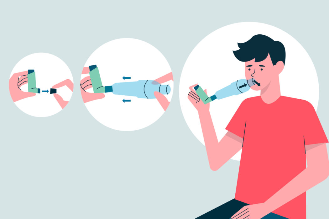 Como usar uma câmara expansora | CUF