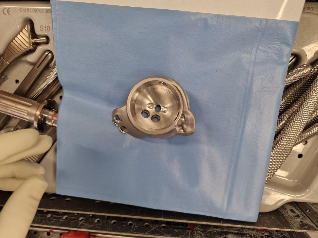 Hospital CUF Tejo: Cirurgia com prótese de anca personalizada | CUF