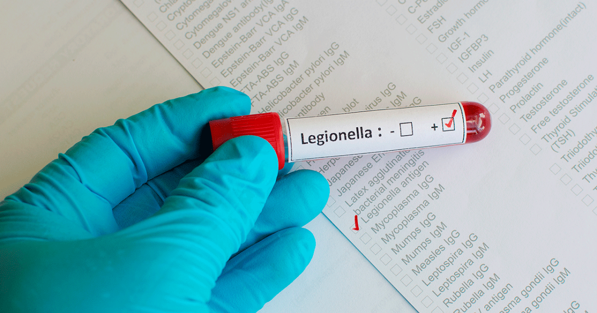 Aprenda a reconhecer a Legionella | CUF