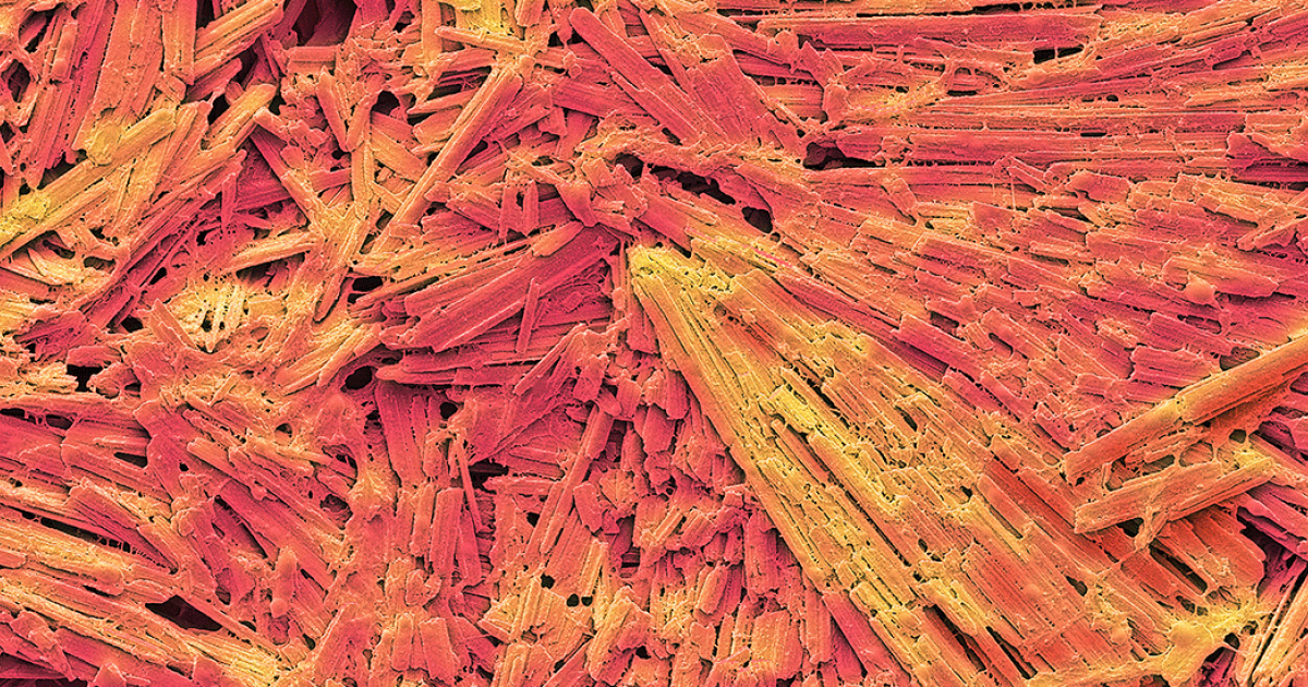 Gota: o que é, sintomas e tratamento | CUF