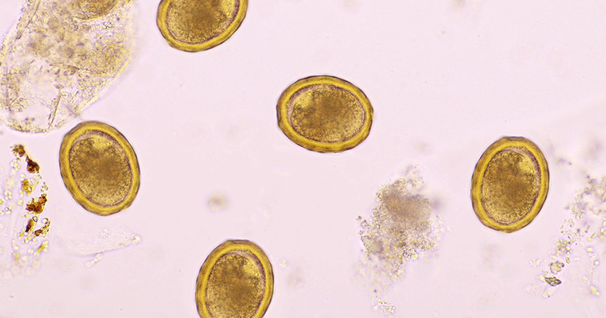 O Que é Parasitoses - FDPLEARN