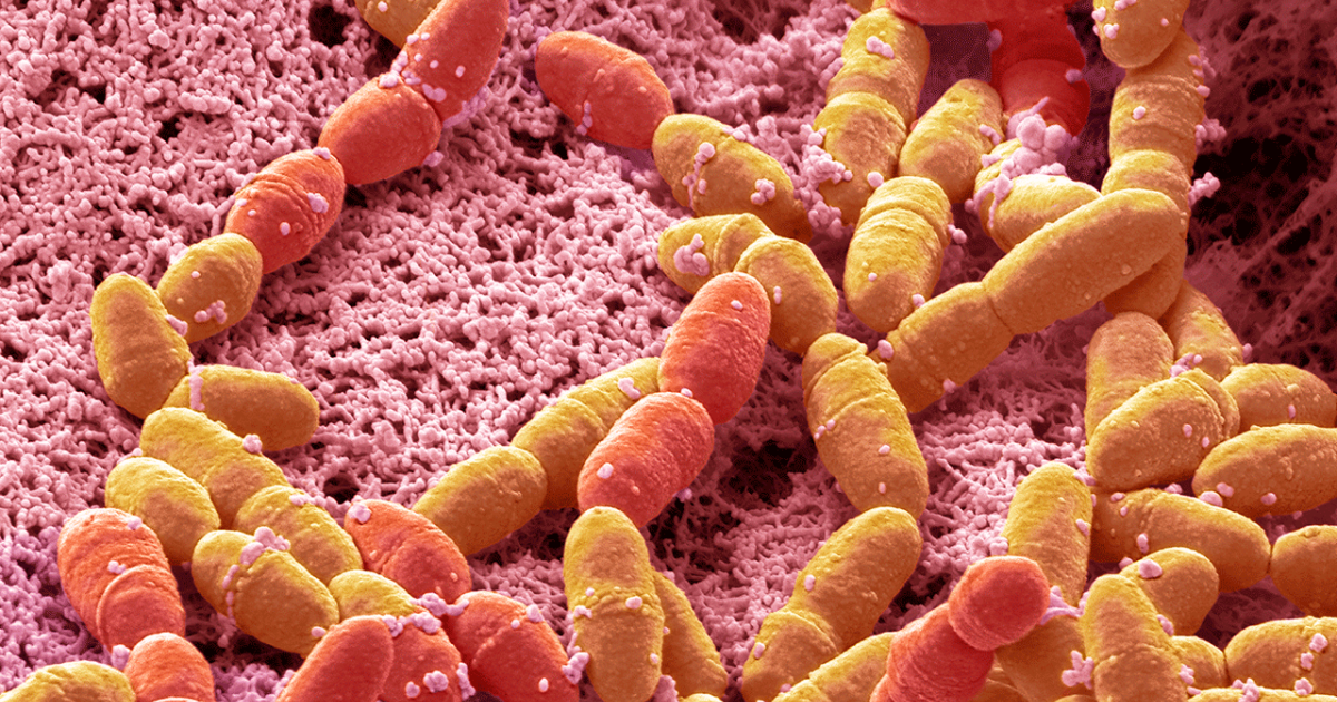 Amigdalite: o que é, sintomas e tratamento | CUF