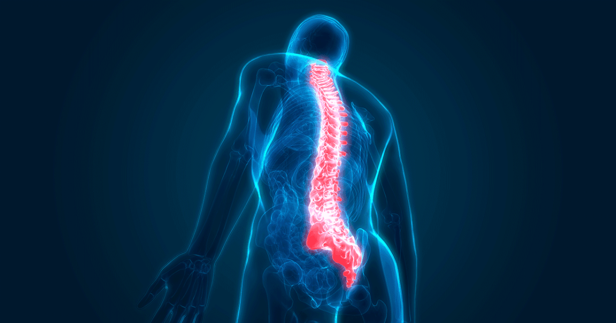 Fratura da coluna: o que é, sintomas e tratamento | CUF