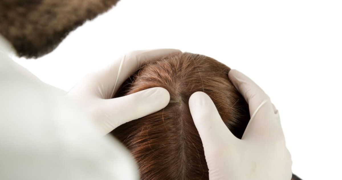 Infeções do couro cabeludo: o que é, sintomas e tratamento | CUF