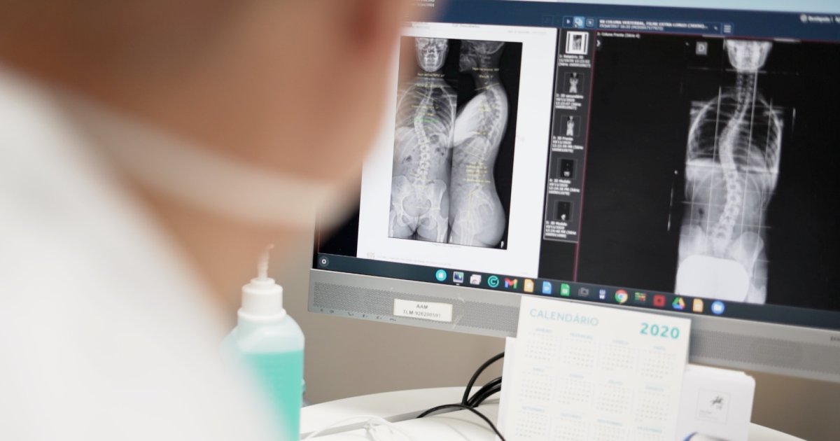 EOS: Uma radiografia de corpo inteiro com menos radiação | CUF