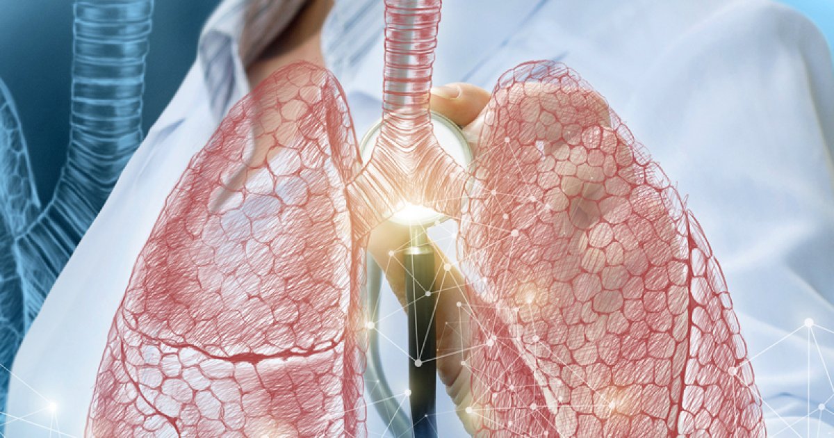 Curso de Doenças Obstrutivas Crónicas das Vias Aéreas | CUF