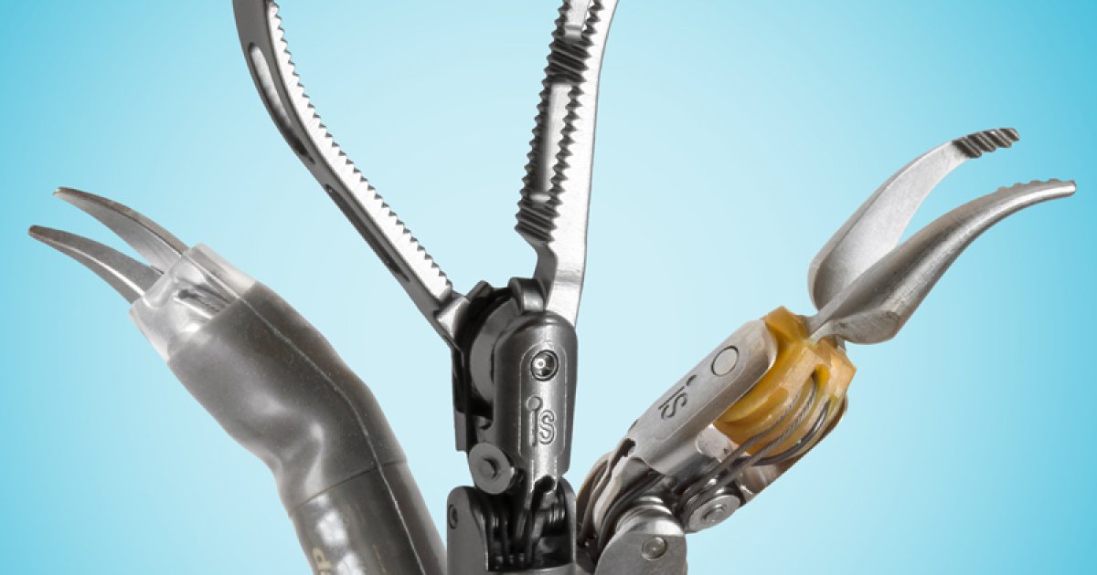 Robotic or laparoscopic simple prostatectomy | CUF