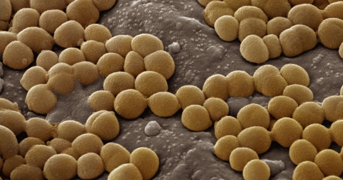 Furúnculo: o que é, sintomas e tratamento | CUF