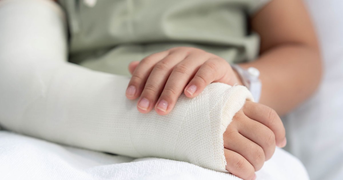 Gesso ou tala gessada: que cuidados ter | CUF