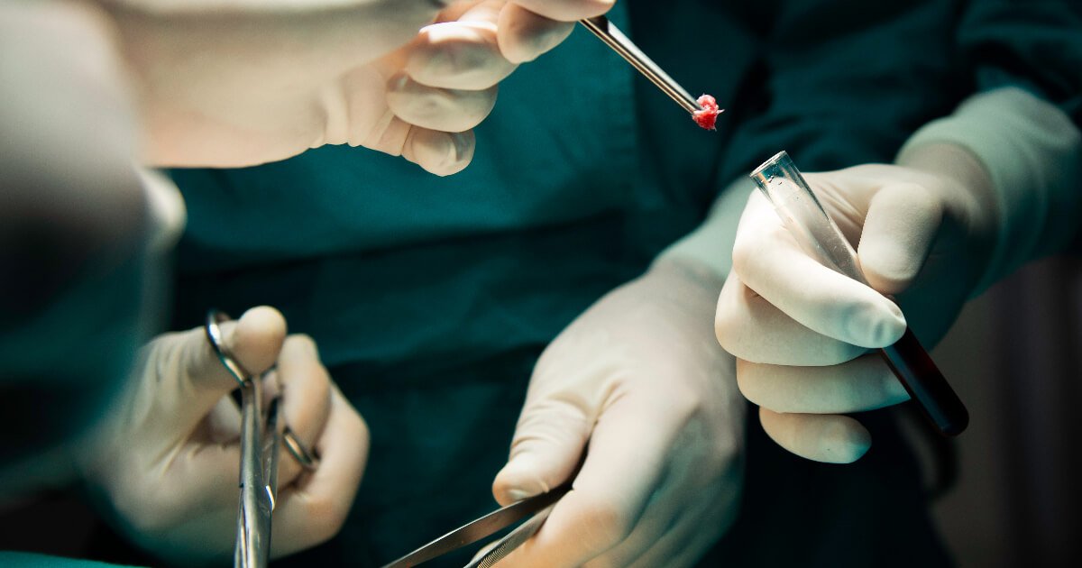 Biópsias: o que é, metodologia e indicações | CUF