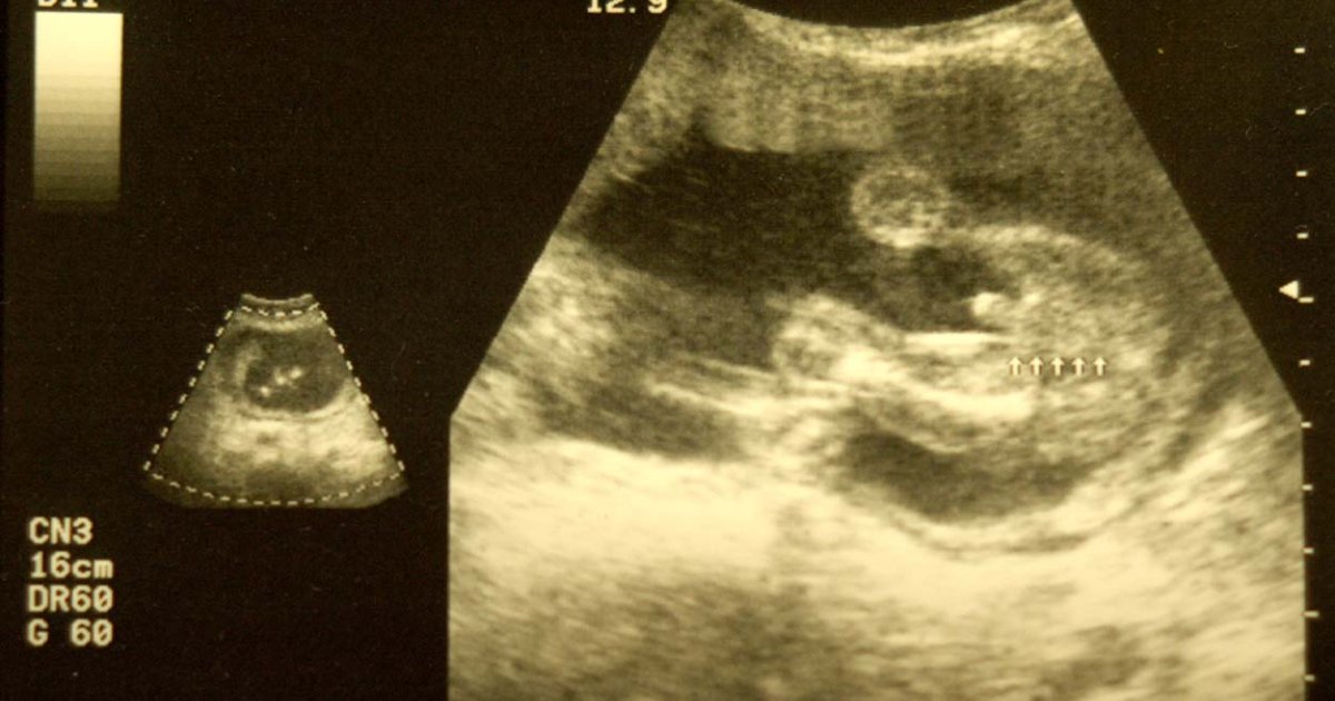 Fimose: o que é, sintomas e tratamento | CUF