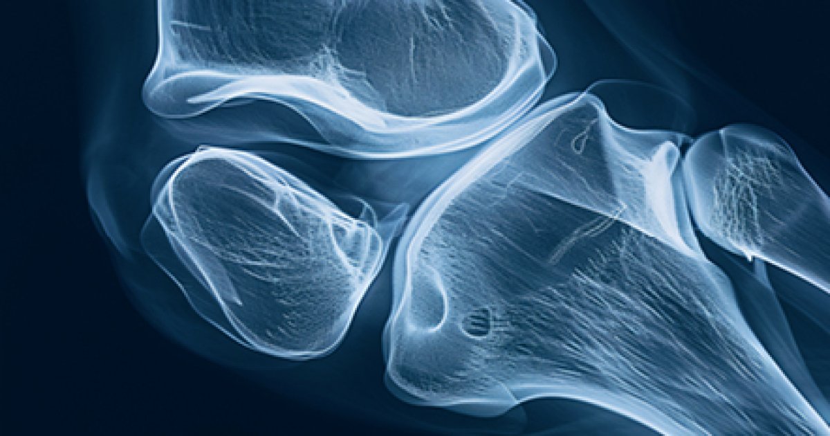 CUF Knee Meeting 2025 | CUF