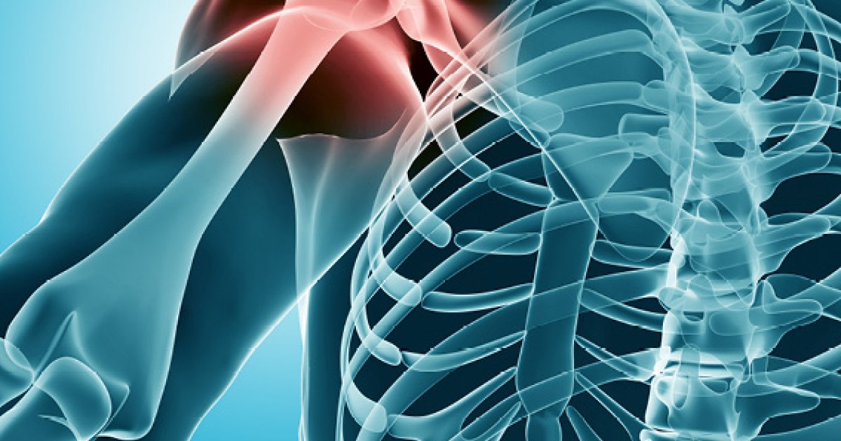 Shoulder Course for Residents and Young Surgeons | CUF